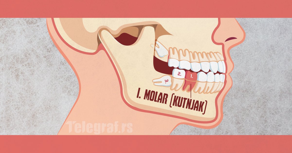 Ovo je najvažniji zub u vilici: Evo zašto je poseban i zašto zubari ...