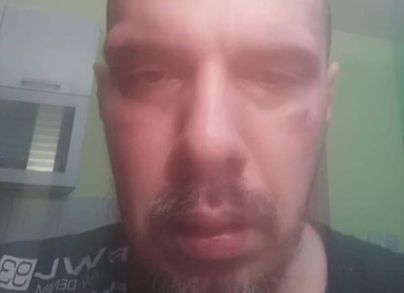Pretučen Bojan Tomović! - Telegraf.rs