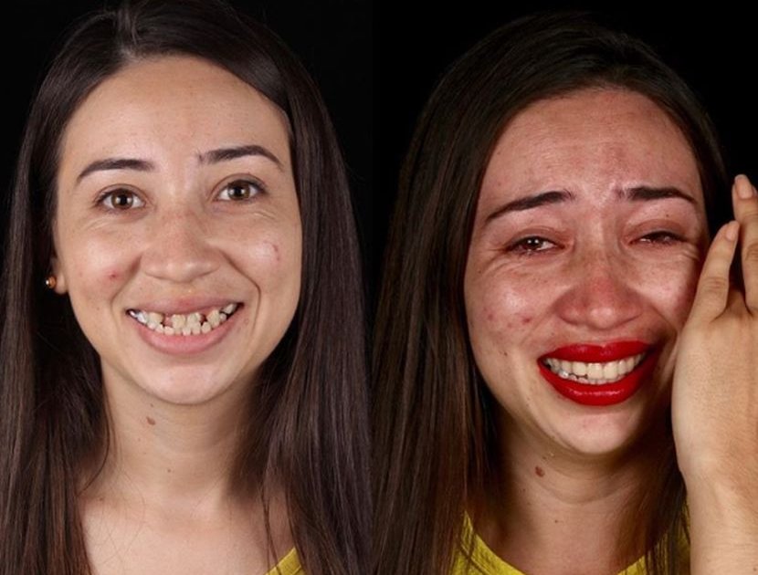 Nije sve u novcu: Zubar siromašnima poklanja novi osmeh, a fotke ...