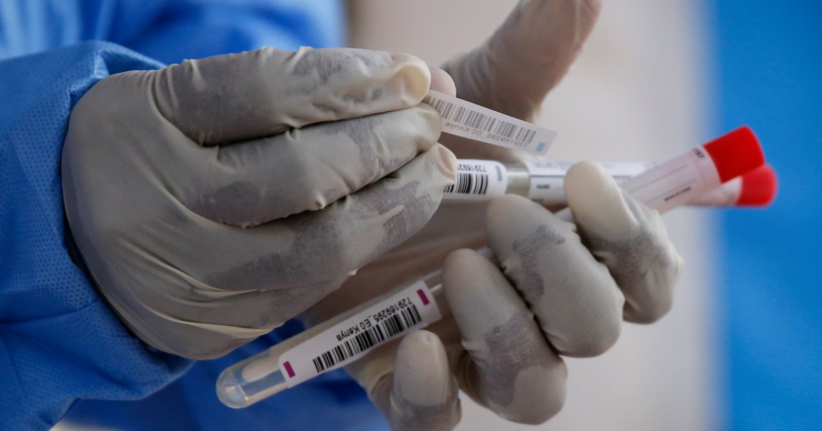 Gde i kako uplatiti 1.200 dinara za testiranje na antitela: Uputstvo za ...