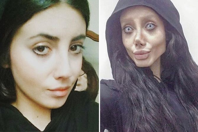 Zombi verzija Anđeline Džoli na respiratoru zbog korona virusa: Bolest ...