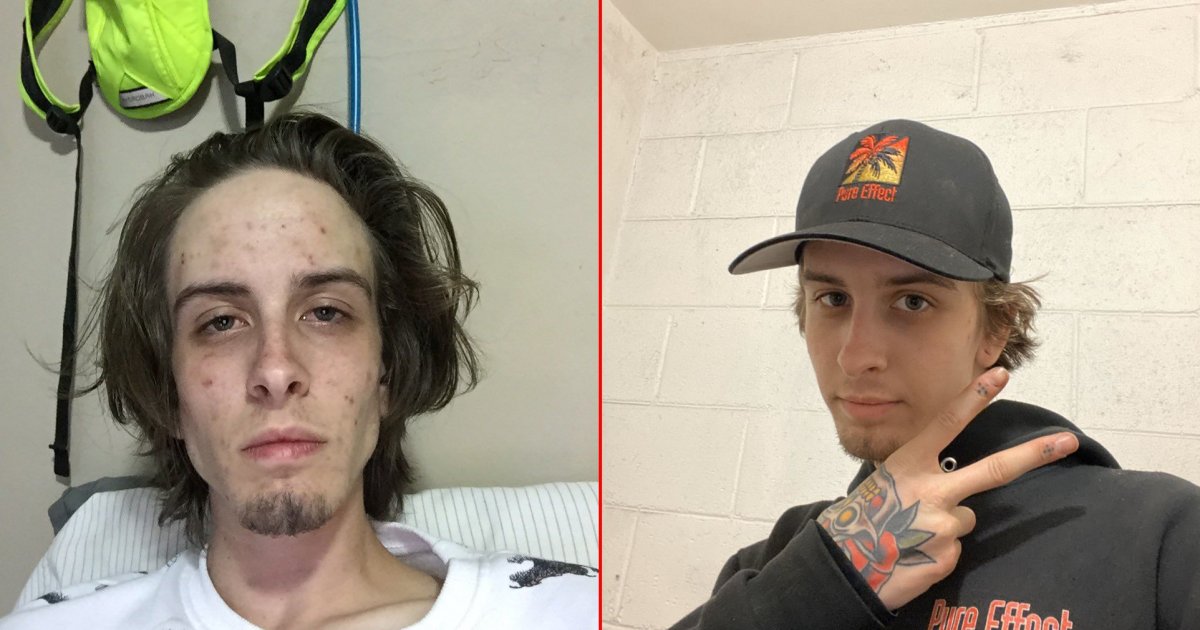 Svi šeruju fotografiju ovog mladića: Ovako danas izgleda bivši narkoman ...