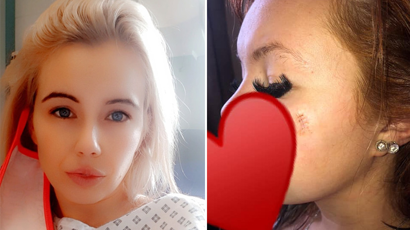 Sestrama je istovremeno dijagnostikovan rak kože: Ovo je bila jedina ...