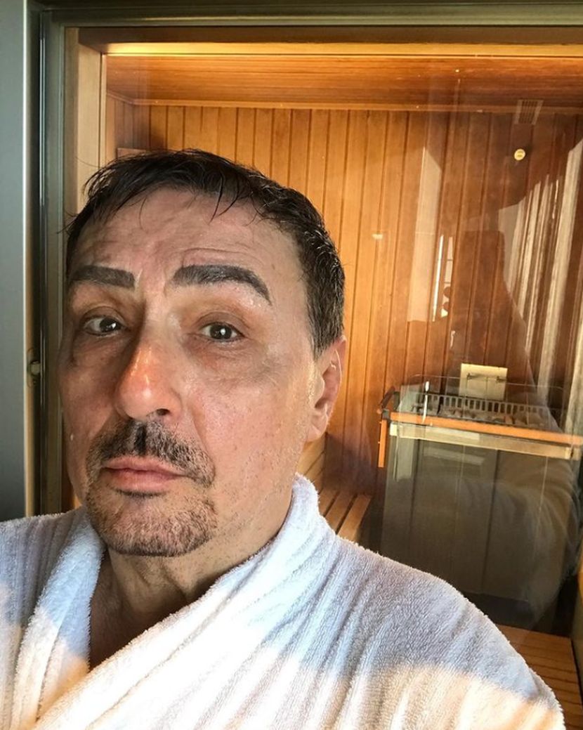 Keba postao travar: Počinje da leči gljivične infekcije, ekceme ...