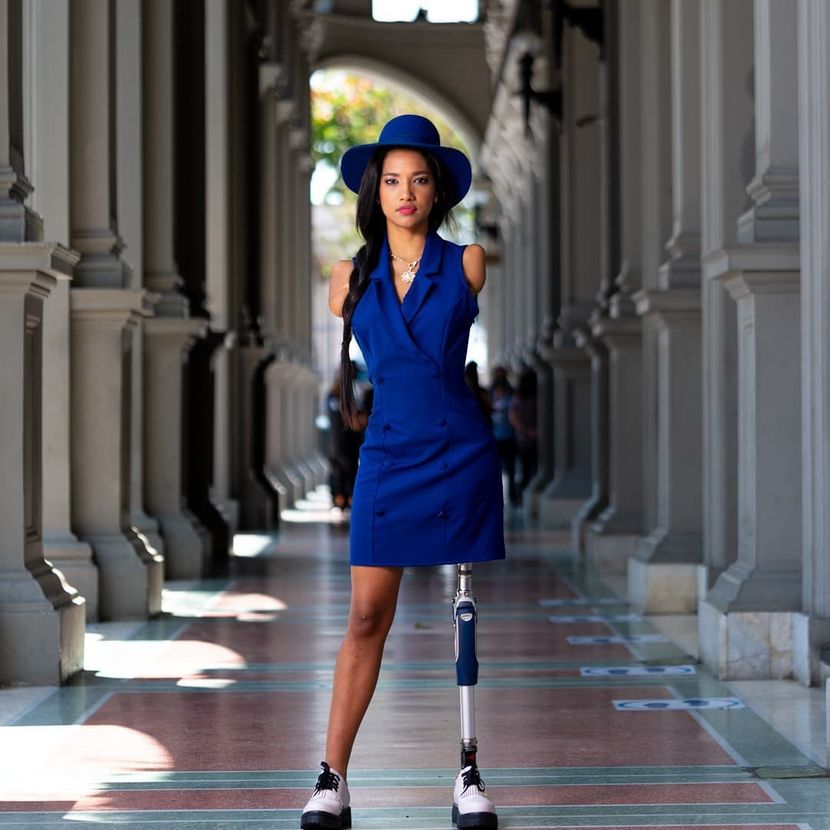 Viktorija je manekenka sa invaliditetom koja ruši sve predrasude: Ona ...