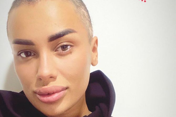 Nataša Radan obrijala glavu, a objašnjenje je frapantno: "Dečko me je ...