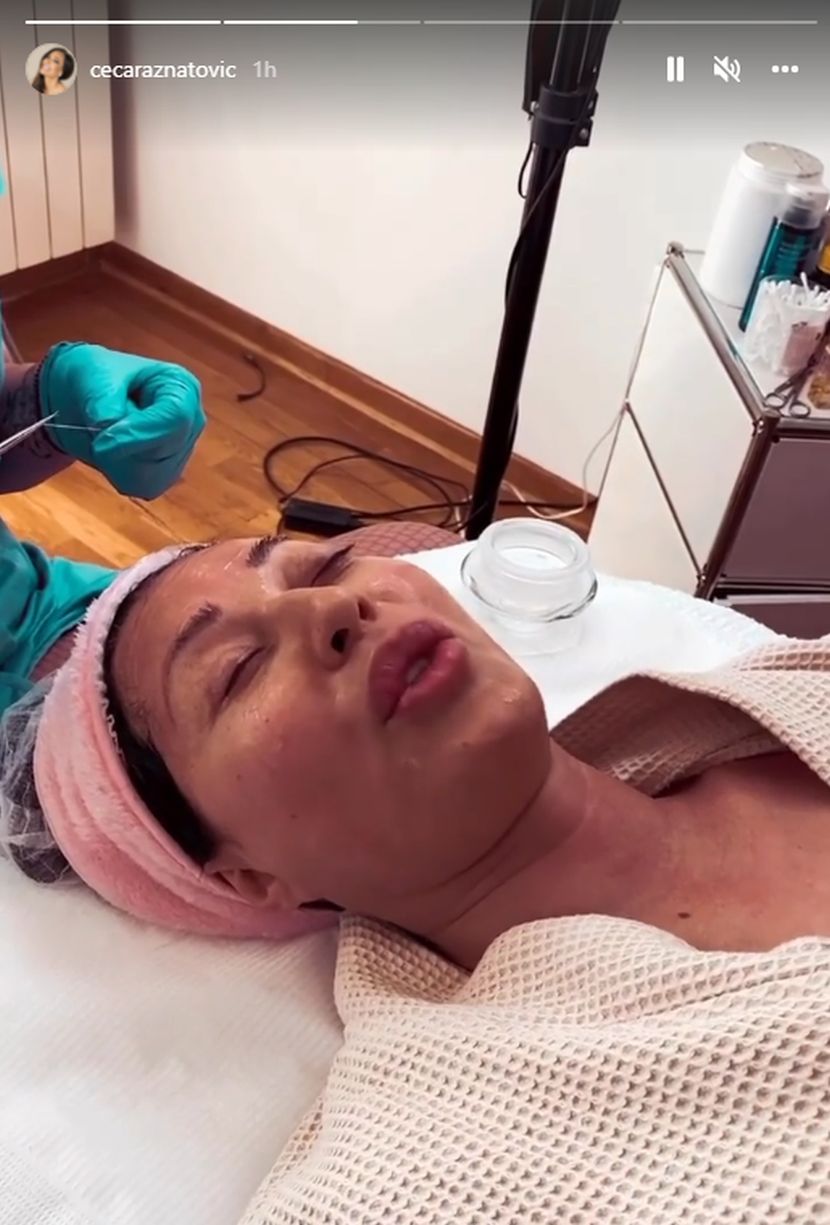 Ceca pokazala lice bez trunke šminke: Ovaj tretman koristi za ...