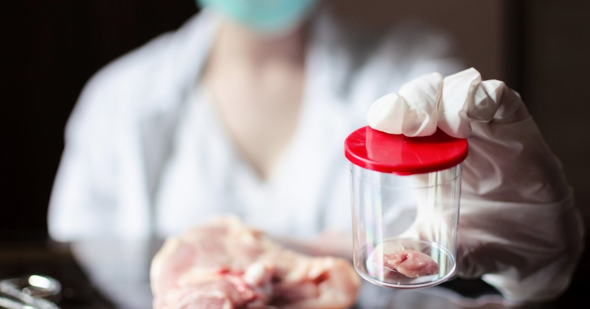 Donosimo detalje novog pravilnika za trihinelu: Dovoljno je parčence ...