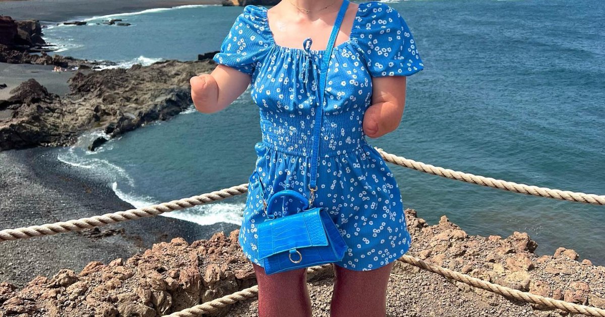 Kao dete je ostala bez ruku i nogu, ali do ciljeva stiže voljom i ...