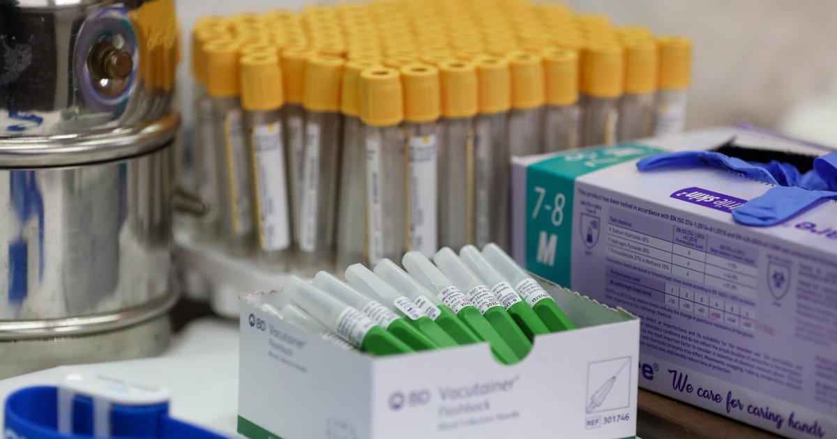 Besplatna testiranja na HIV u petak i subotu - Telegraf.rs