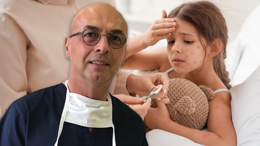 Upozorenje pedijatra na morbile: Ne rovitoj deci u kolektivu - Telegraf.rs