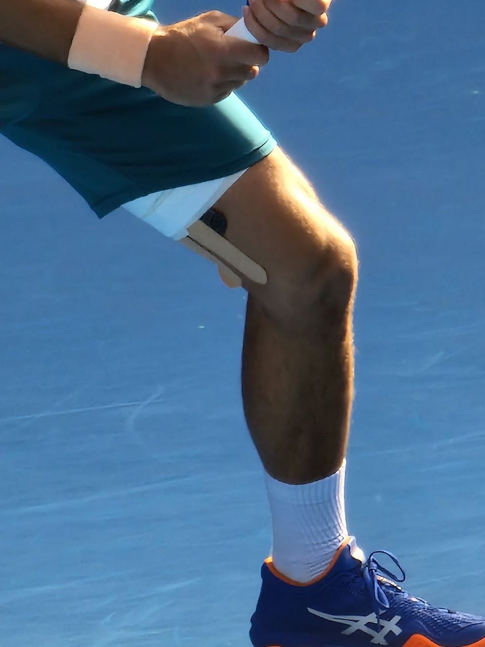 Evo kako izgleda Novakova noga za meč sa Dimitrovim - Telegraf.rs