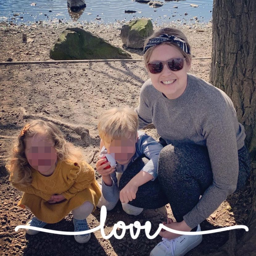 Modrice bez udarca kao simptom leukemije - Telegraf.rs