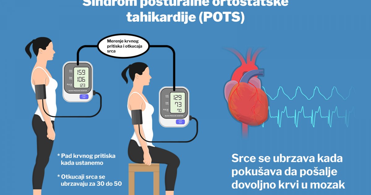 Stanje zvano POTS poraslo je nakon kovida - Telegraf.rs