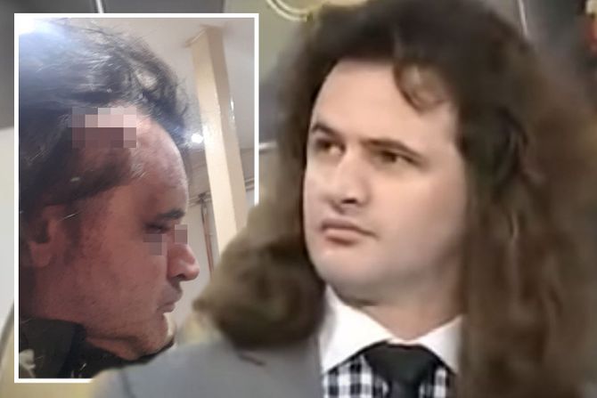 Pevač Lepi brutalno prebijen - Telegraf.rs