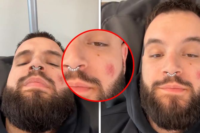 Prvi snimak Nućija nakon pucnjave u Beton hali: Ogrebotine na licu, a evo kako se reper opušta ...