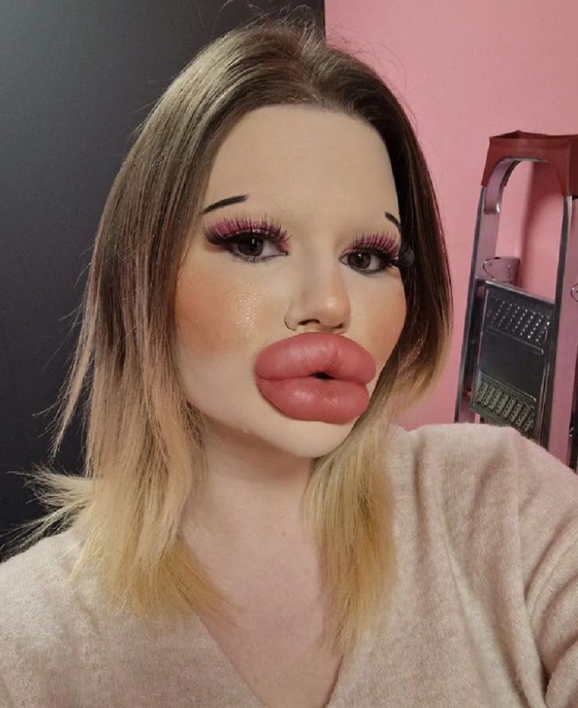 Andrea je vlasnica najvećih usana na svetu, ali ne namerava da stane ...