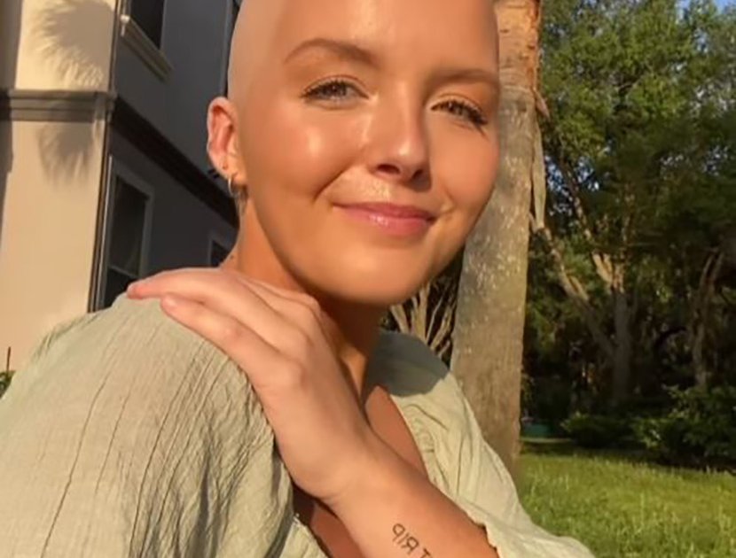 Nakon što je izgubila kosu usled raka vaspitačica istetovirala glavu ...