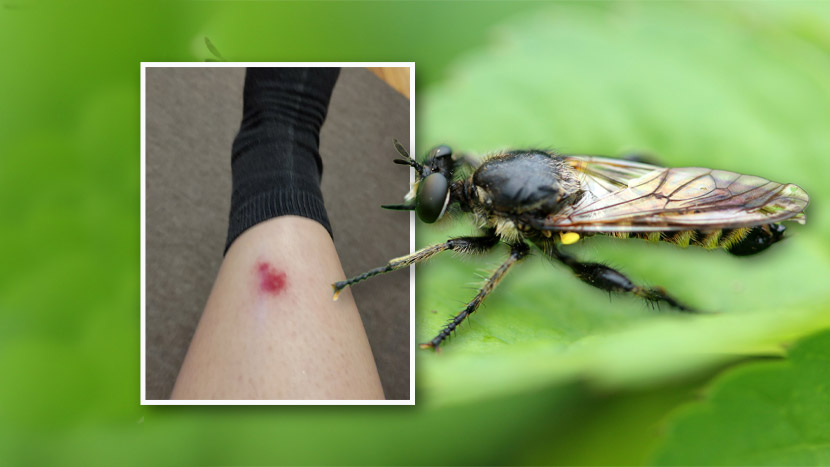 Zbog ujeda bube dali mi antibiotik, 4. dana nisam mogla da zgazim ...