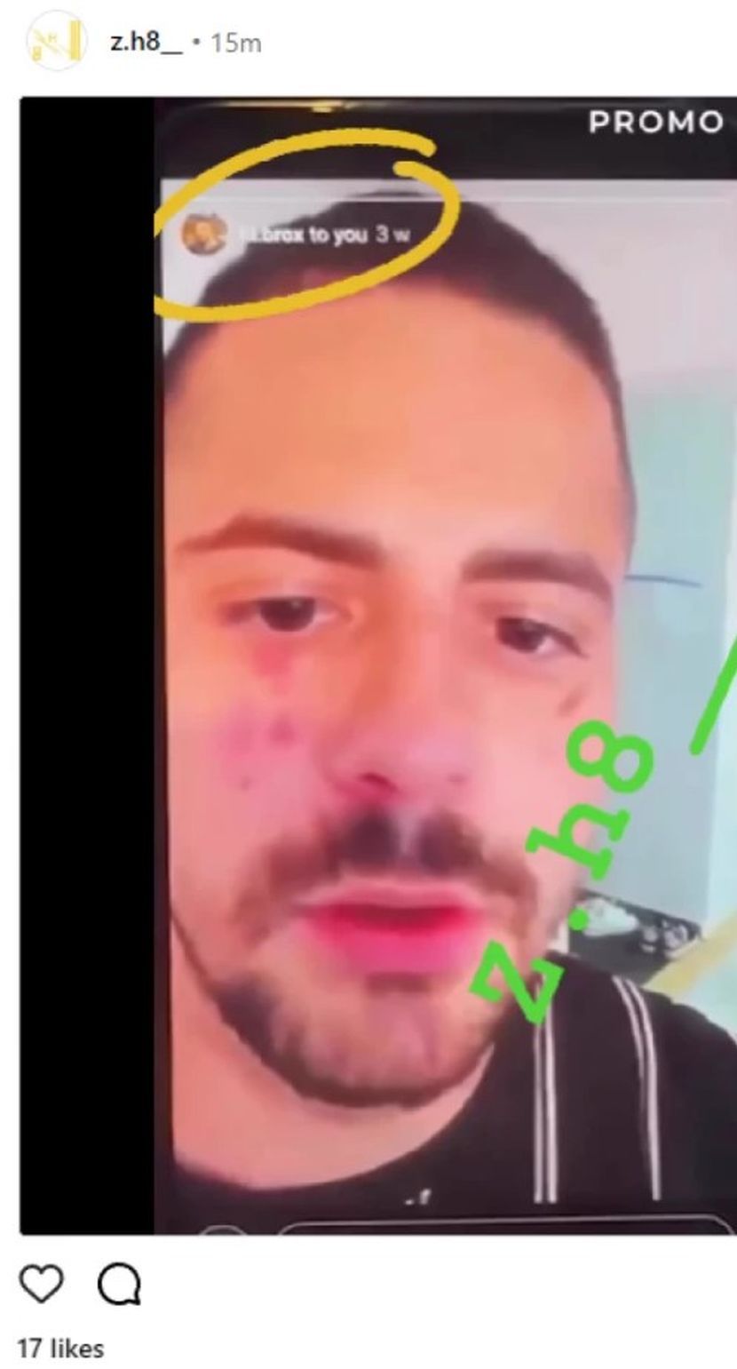 Pretučen Bilal Brajlović - Telegraf.rs