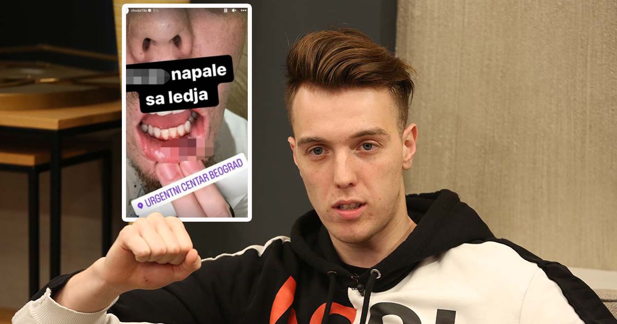 Jutjuber slagao da je pretučen! Slikom prestravio pratioce, pa poručio ...