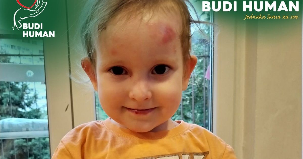 Humanitarni koncert studenata za malog Marka: Celo telo mu je u ...