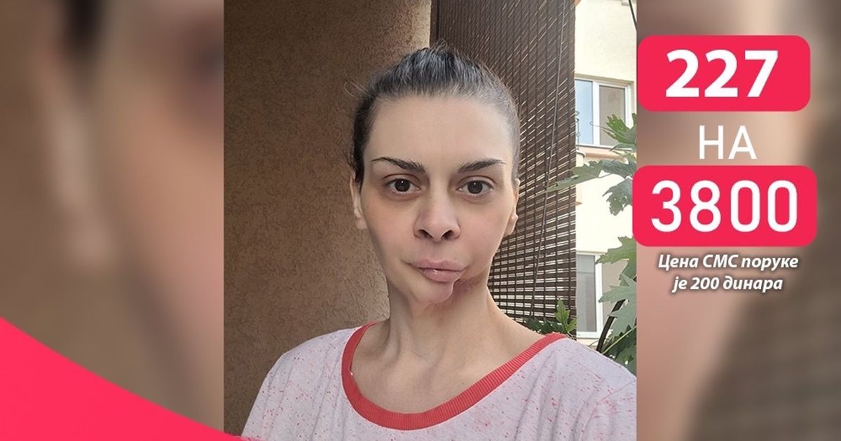 Nataša (45) je osetila bol u vilici i napipala čvor: Vremenom je samo ...