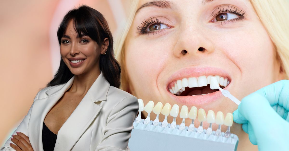 Sve što treba da znate o estetskim korekcijama zuba: Da li se zbog ...
