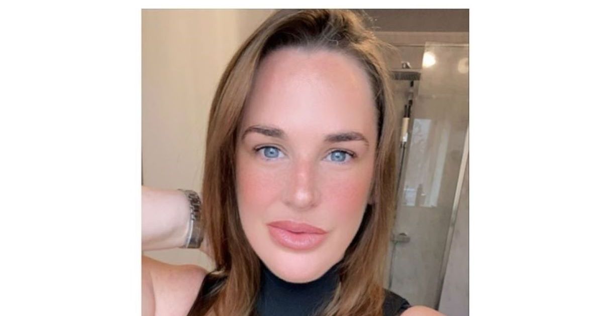 Obožavala je solarijum, a onda joj je ostavio rupu u nosu: Zahvaljujući ...