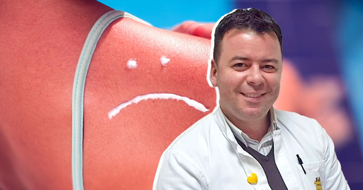 Šta znači SPF 15, 20, 30, 50: Dermatolog preporučuje šta je najbolje za ...