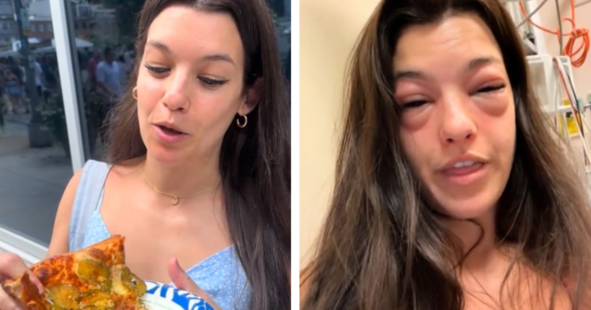 Pojela parče pice, a nakon 3 sata otekla kao da je glavu gurnula u ...