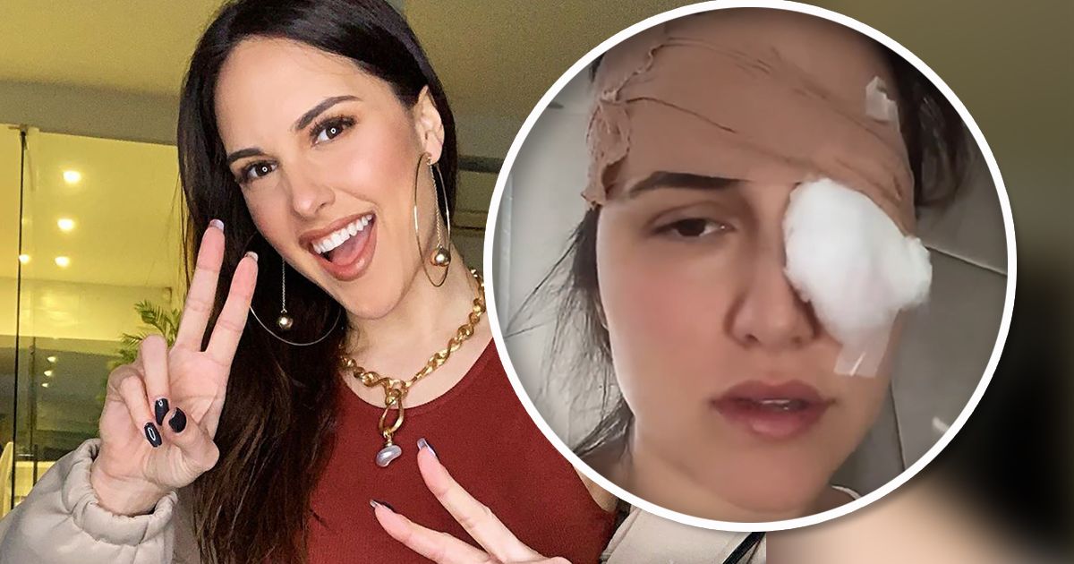 Poznata pevačica doživela ozbiljnu povredu oka: "Mislila sam da nije ozbiljno, ali...", a ovo su ...