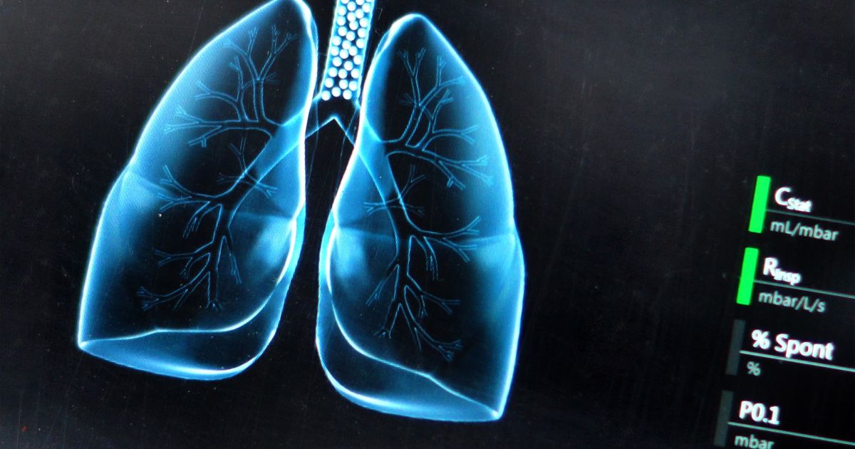 Prof. dr Kopitović, pulmolog savetuje: Kako se rešiti kašlja? - Vesti ...