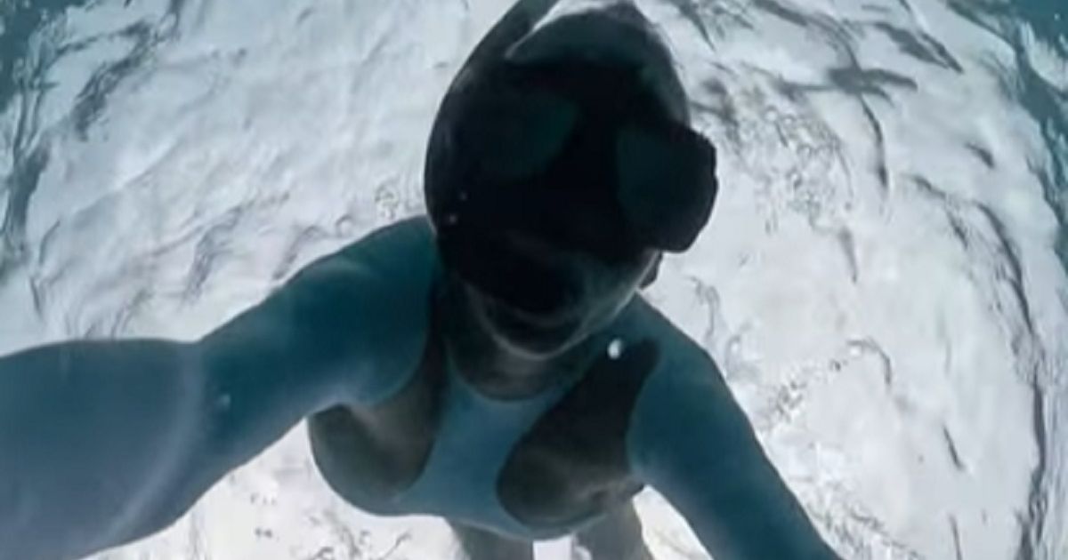 Hrvatsku influenserku na Maldivima ujela ajkula: Pokazala na mrežama izujedanu ruku, sledila se ...