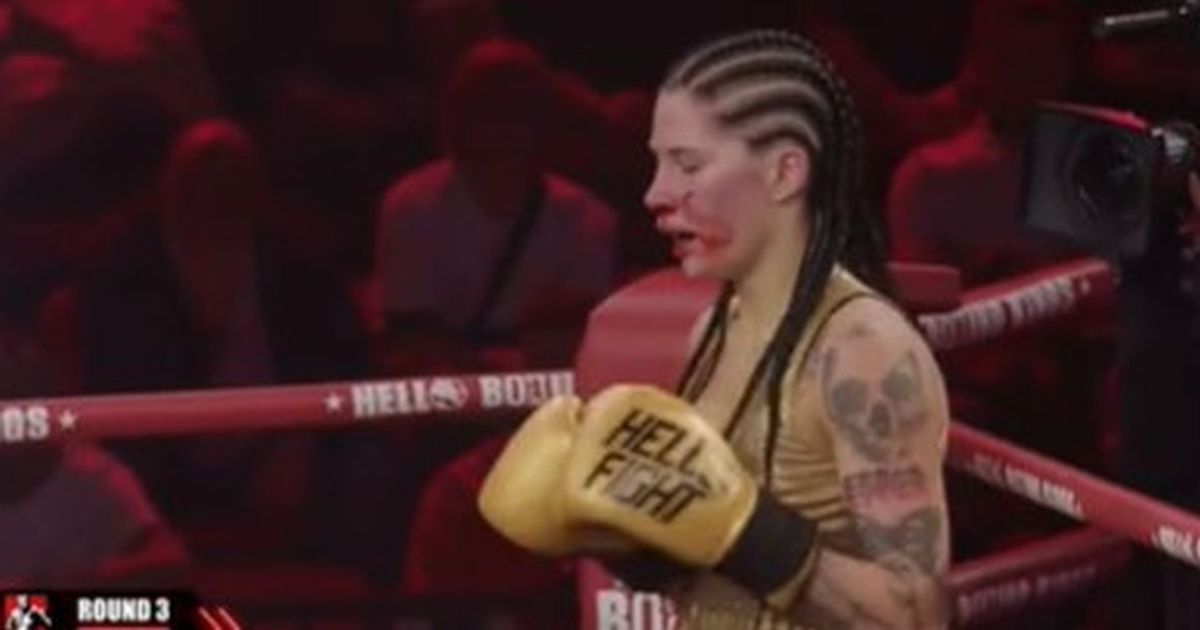 Uki Q pretučena, pogledajte jezivi krvavog lica poznate influenserke - Telegraf.rs