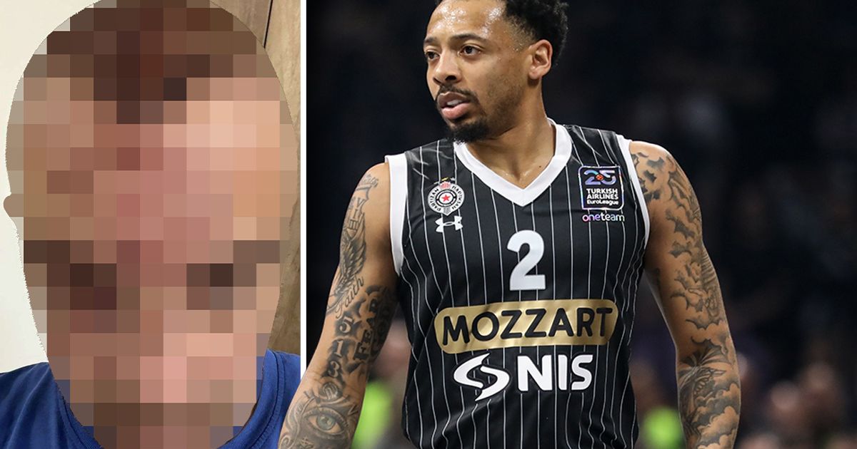 Uznemirujuće! Ovako izgleda momak kome je Karlik Džons slomio flašu o ...