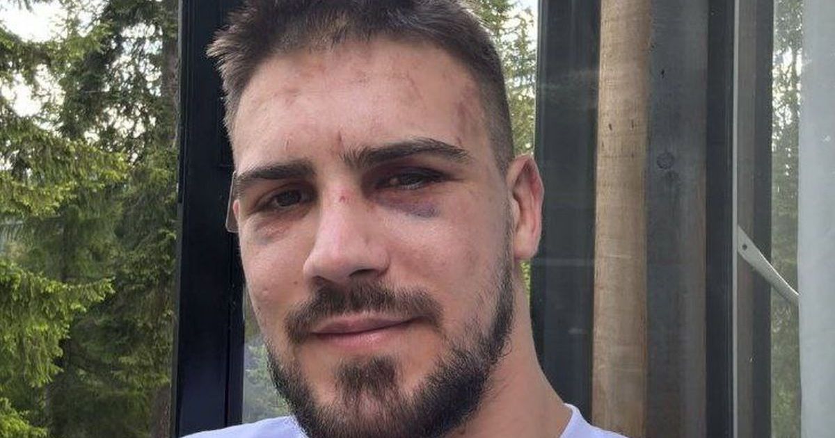 Marko Bojković pokazao lice prvi put nakon meča sa Janičićem i našalio se: "Face ID je radio ...