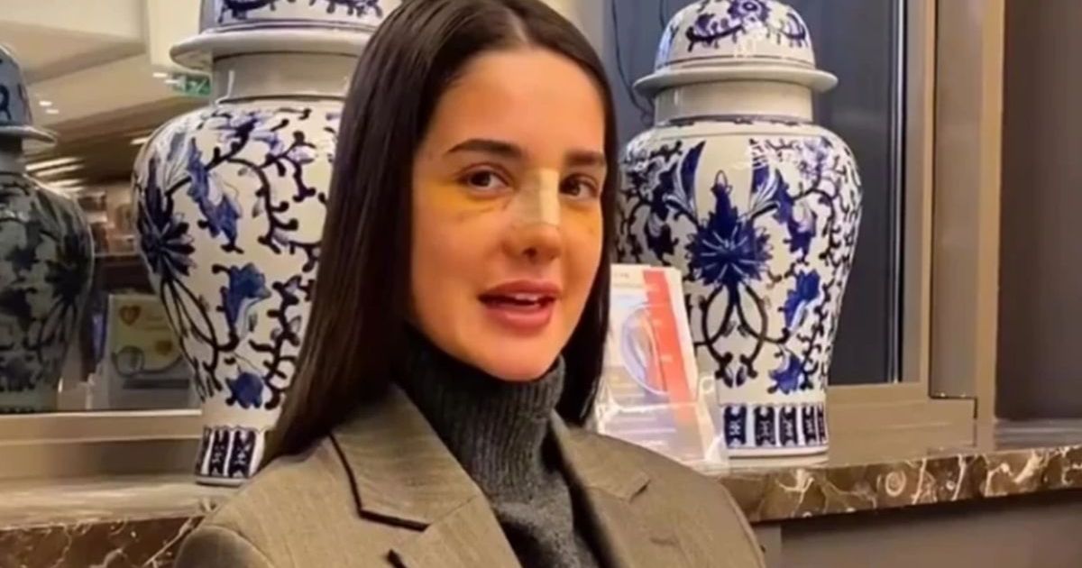 Anđela pokazala prve slike nakon operacije nosa: Oglasila se iz Turske ...